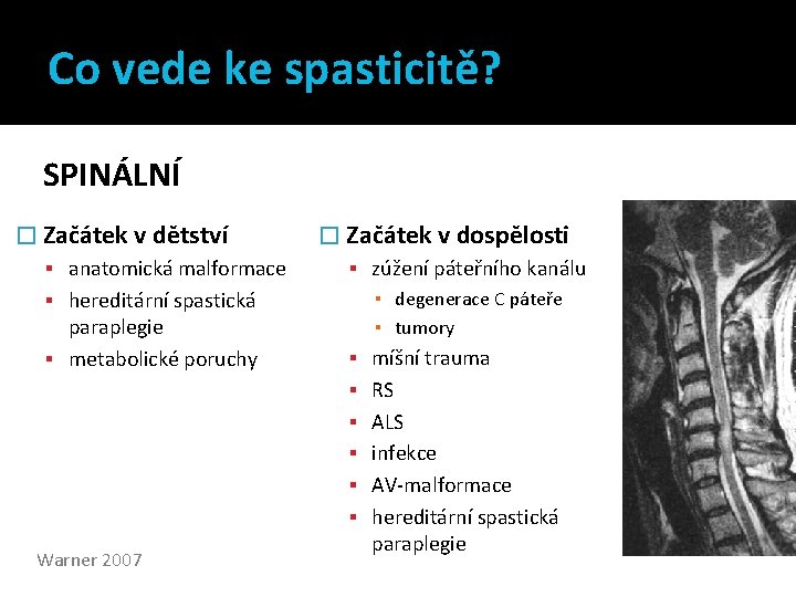 Robert Jech Spasticita Neurologick klinika 1 LF UK
