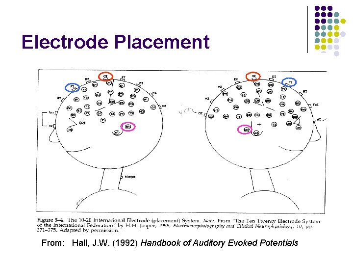 Introduction to Cortical Auditory Evoked Potentials CAEP Manufactured
