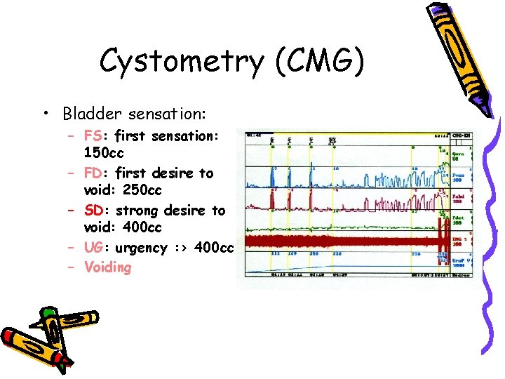 Urinary incontinence Urinary incontinence is a condition in