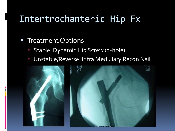 Lower Extremity Trauma Hip Fractures Dislocations Femur Fractures