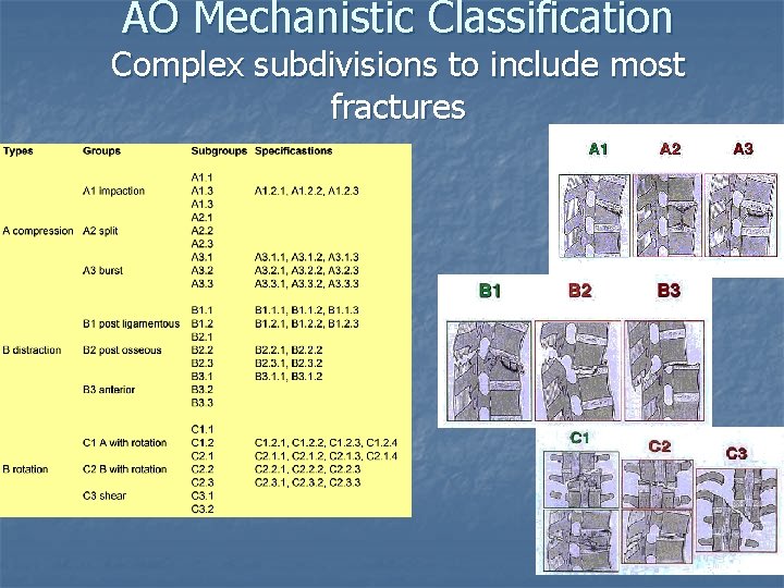 Traumatic conditions of DorsoLumbar spine Anatomy of Thoracic