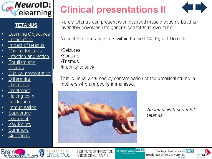 TETANUS Learning Objectives Introduction Impact of tetanus Clinical
