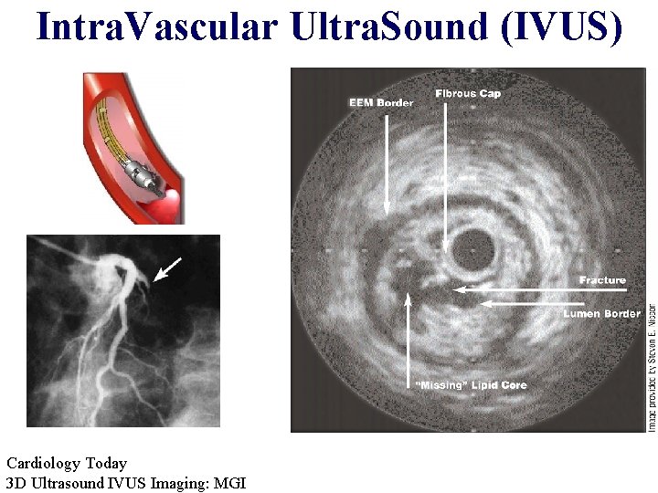New Advances in Cardiology September 2002 Manila Philippines