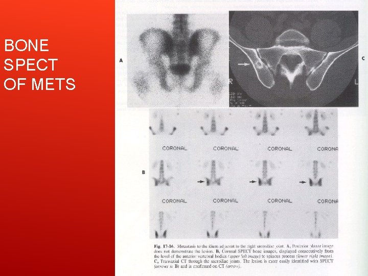 BONE DISEASE A Diagnostic Look NORMAL Normal uptake
