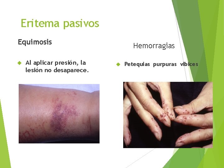 PROPEDUTICA Dermatolgica PIEL ECTODERMO MESODERMO Epidermis Folculos ...