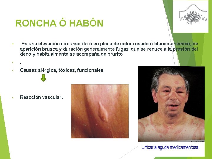 PROPEDUTICA Dermatolgica PIEL ECTODERMO MESODERMO Epidermis Folculos ...