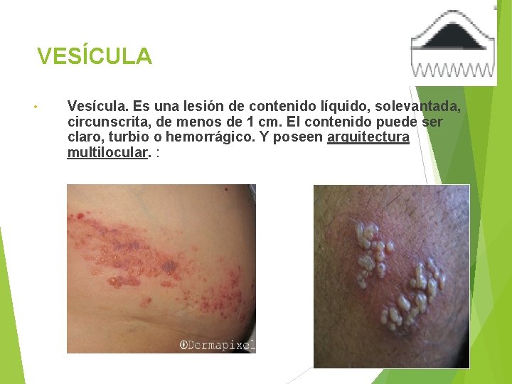 PROPEDUTICA Dermatolgica PIEL ECTODERMO MESODERMO Epidermis Folculos ...