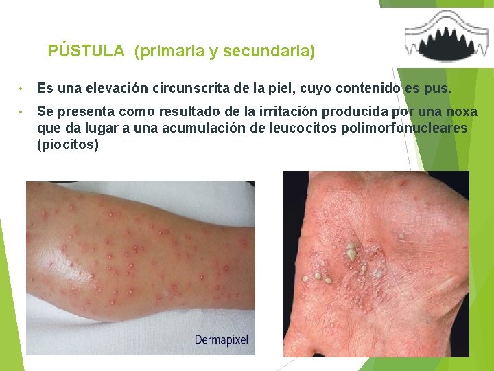 PROPEDUTICA Dermatolgica PIEL ECTODERMO MESODERMO Epidermis Folculos ...