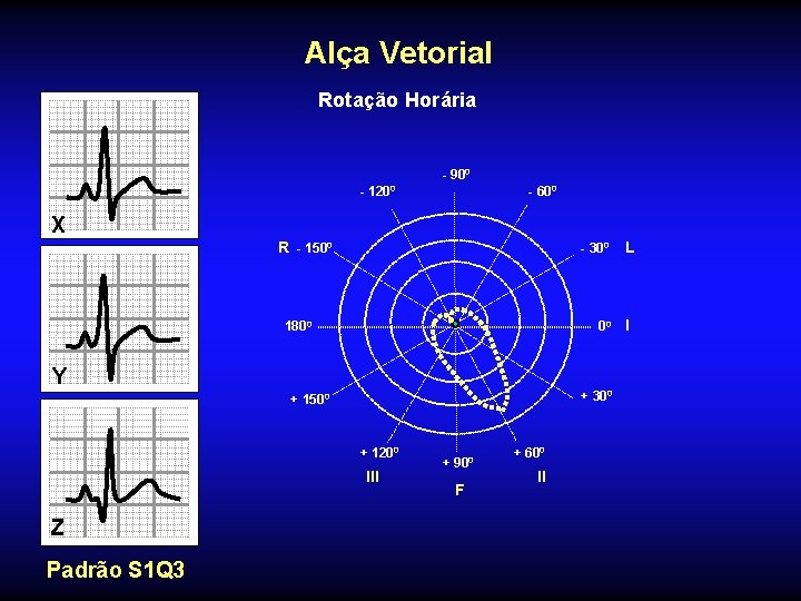 Eletrocardiografia Clnica MDULO V O Vetocardiograma O VETOCARDIOGRAMA