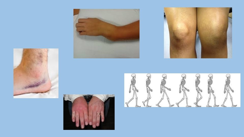 Documentation SOAP Notes Documenting Injury Evaluation Information Complete