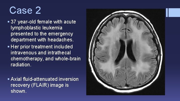 MR Imaging of PostTreatment Changes in the Brain