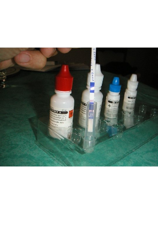 Les streptocoques Classification Coques Gram positif Progrs de