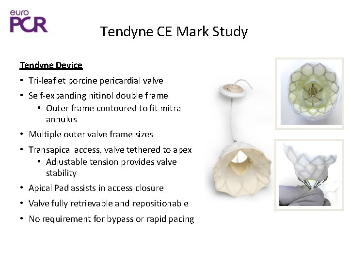 CE Mark Study of Transcatheter Mitral Valve Replacement