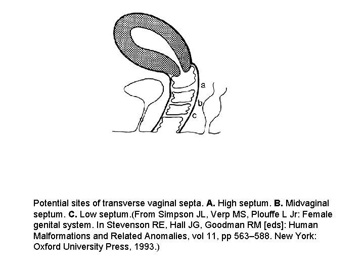 Normal and Abnormal Embryology of the Female Genital