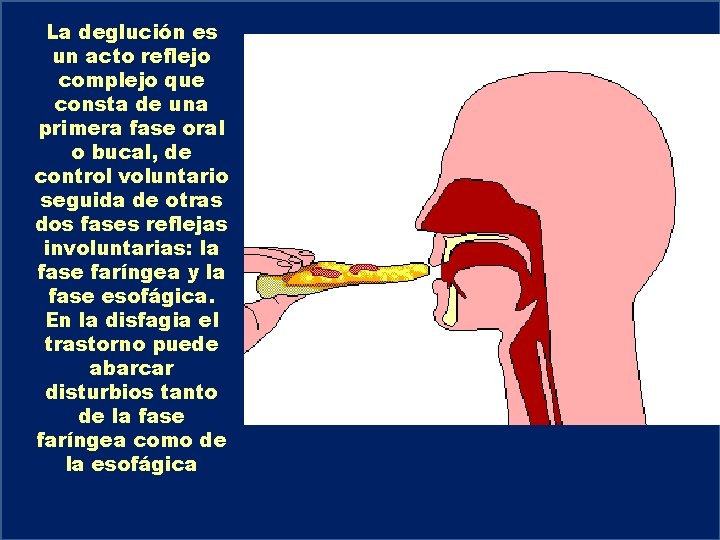 TRASTORNOS MOTORES DE LA DEGLUCIN Y DEL ESFAGO