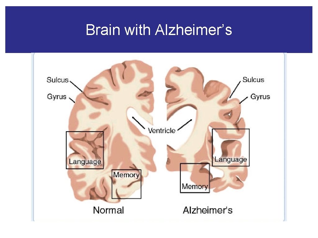 Dementia and Your Practice Rev Jamie Wilson Headley