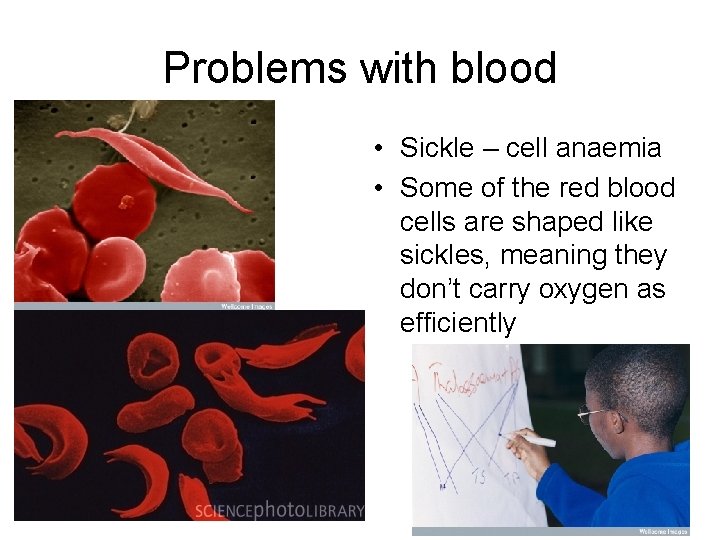 Structure of blood GCSE Applied Science Life Care