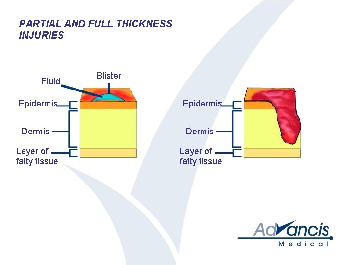 MANAGEMENT AND PREVENTION OF ABNORMAL SCARS LATEST FIGURES