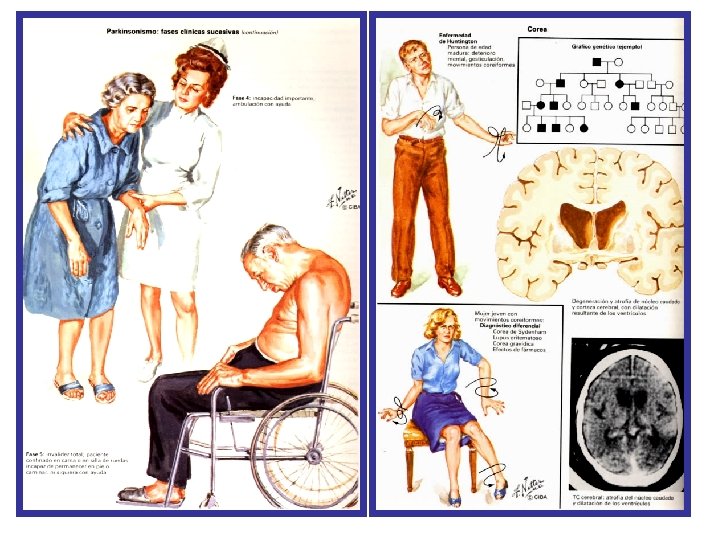 SISTEMA EXTRAPIRAMIDAL SISTEMAS MOTORES Piramidal voluntario ...