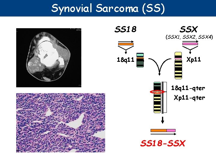 SS 18 SSX IS A CELLCONTEXTDEPEDENT EPIGENETIC REGULATOR