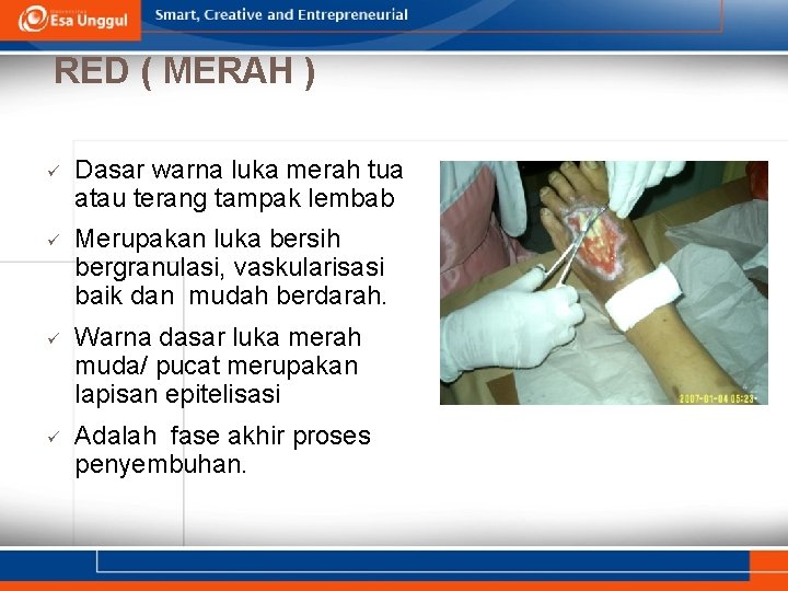 Persiapan Dasar Luka Wound Bed Preparation Pertemuan 5