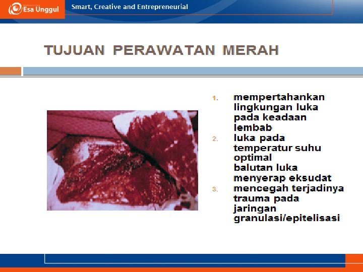 Persiapan Dasar Luka Wound Bed Preparation Pertemuan 5