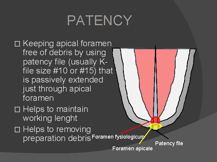TECHNIQUES AND METHODS OF PREPARATION OF ROOT CANALS