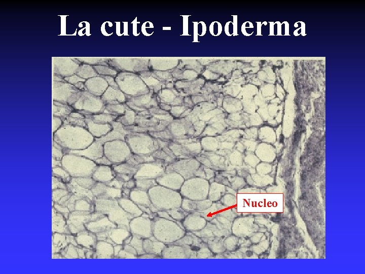 La cute N B Cute e pelle sono