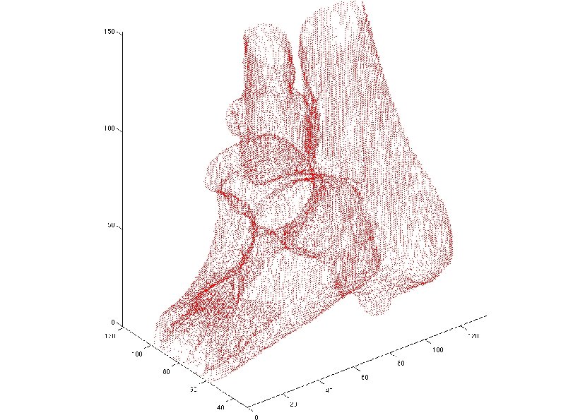 ENGN 2500 Medical Image Analysis Project Progress Presentation