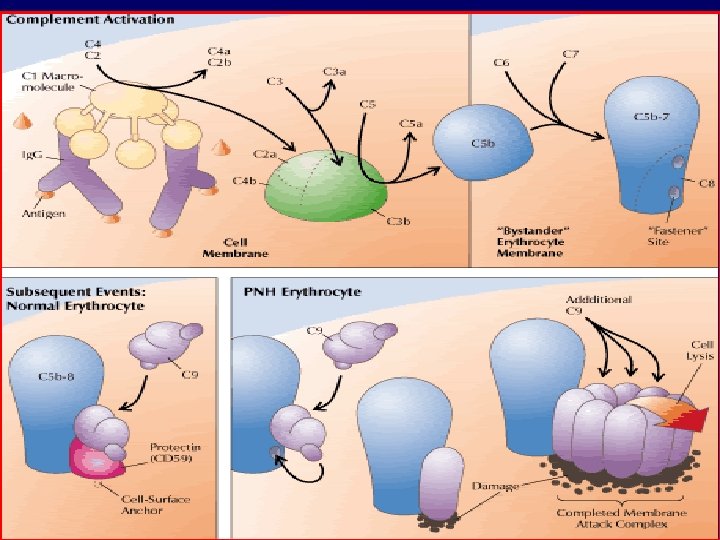 Paroxysmal Nocturnal Hemoglobinuria Paroxysmal Nocturnal Hemoglobinuria l l