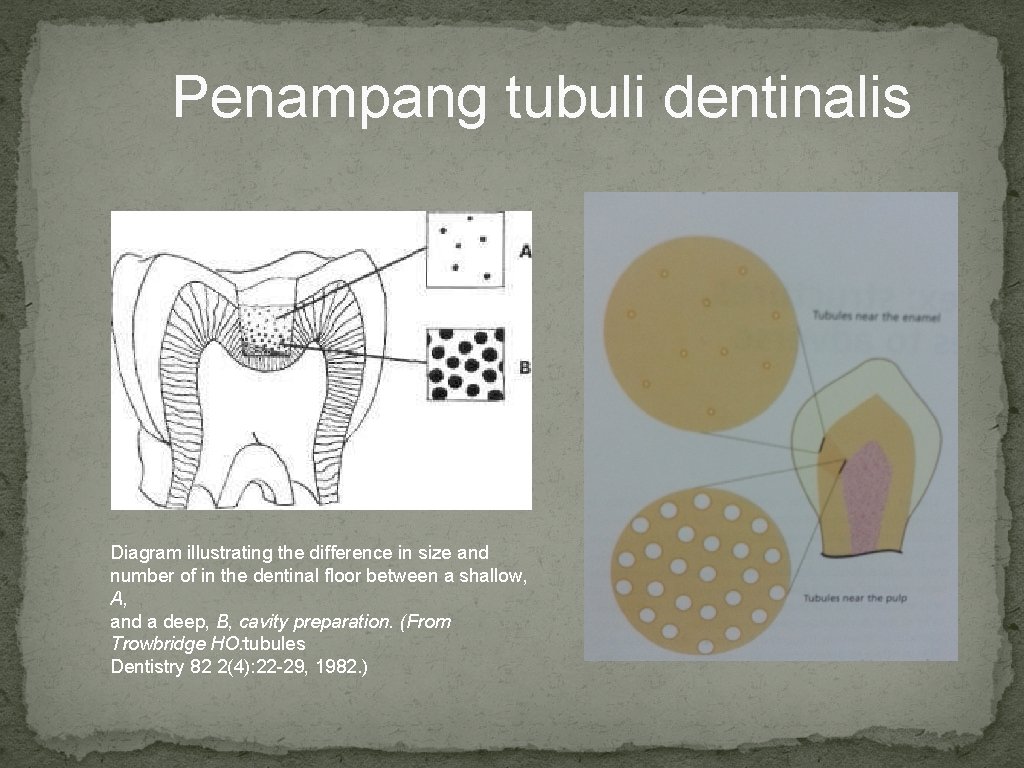 Blok Kedokteran Gigi Dasar Struktur jaringan keras gigi