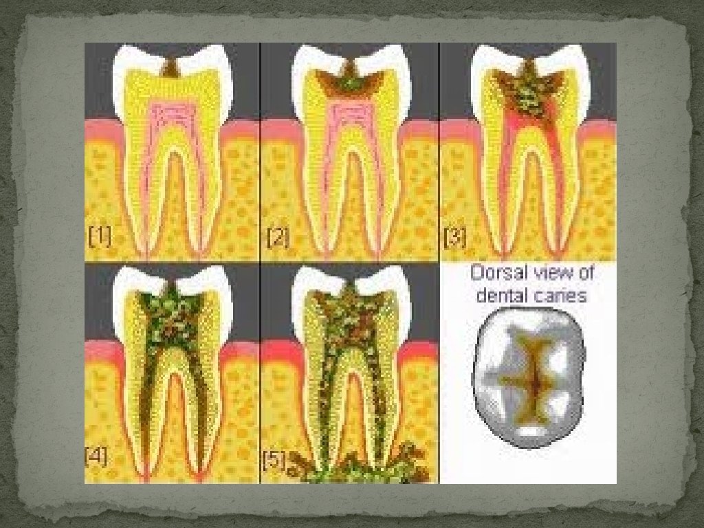 Blok Kedokteran Gigi Dasar Struktur jaringan keras gigi