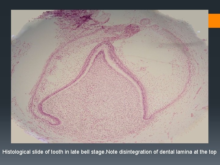 PROCESS INVOLVED IN DETERMINING THE SHAPE OF TEETH