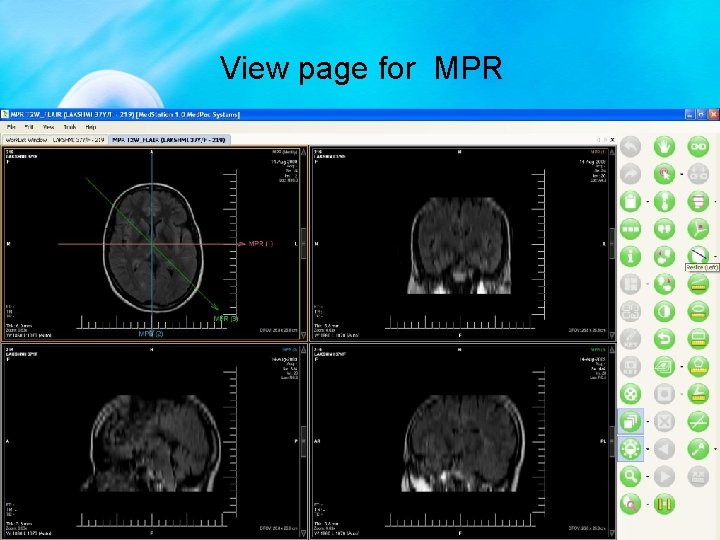 MEDPAC SYSTEMS Making hospitals film less Med Pac