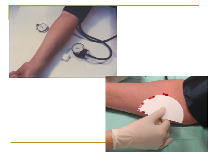 General Approach in Investigation of Haemostasis Lecture 2