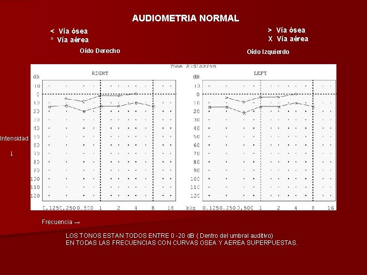 FISIOLOGIA DE LA AUDICION Y EL EQUILIBRIO Dra