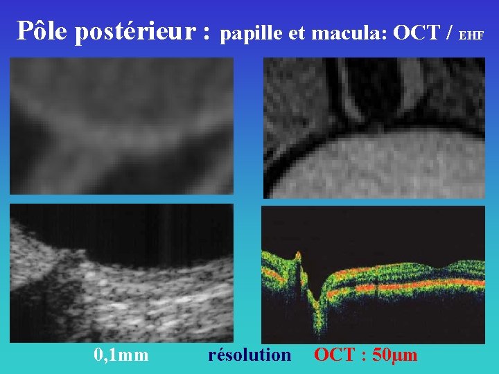 Imagerie de lil US CT IRM Anatomie Smiologie