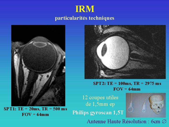 Imagerie de lil US CT IRM Anatomie Smiologie