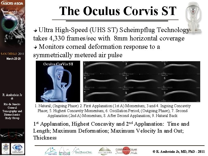 Corneal Biomechanical Assessment using Dynamic Ultra HighSpeed Scheimpflug