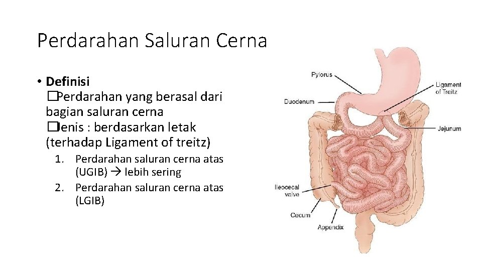 Tatalaksana Nutrisi Perdarahan Saluran Cerna Materi Definisi dan