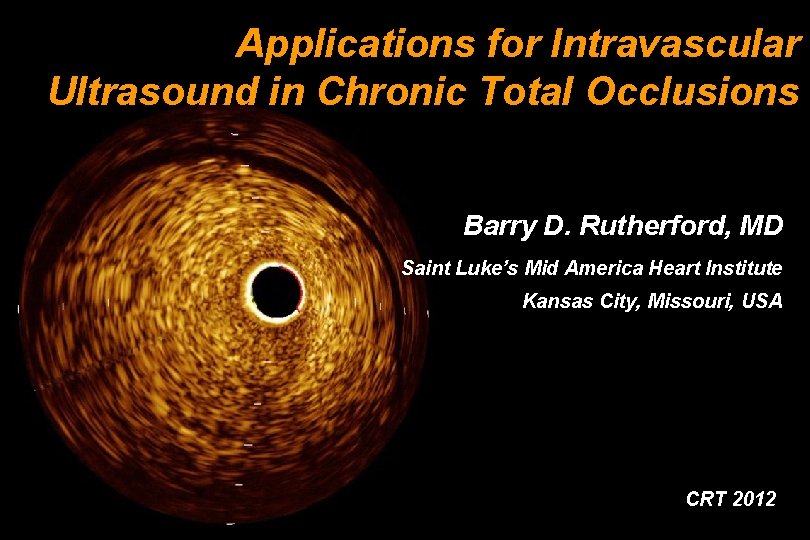 Applications for Intravascular Ultrasound in Chronic Total Occlusions