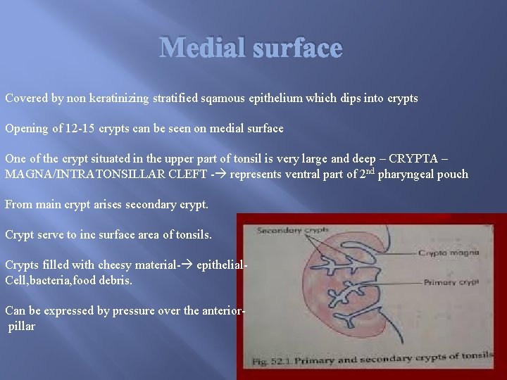 CHRONIC TONSILLITIS By Dr Sharwak Ramlan Is an