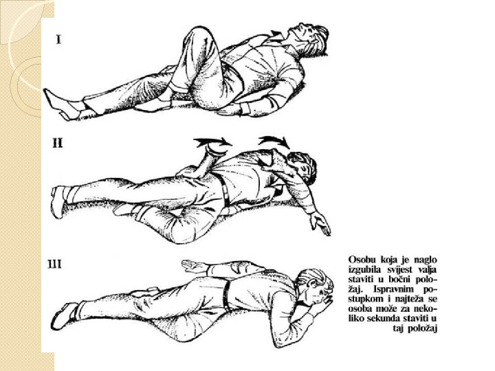 Poloaji bolesnika u krevetu Irena Eisenkohl Novakovi bacc