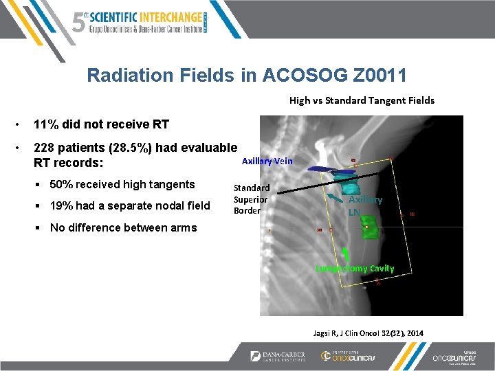 Regional Nodal Radiation Therapy Julia S Wong MD