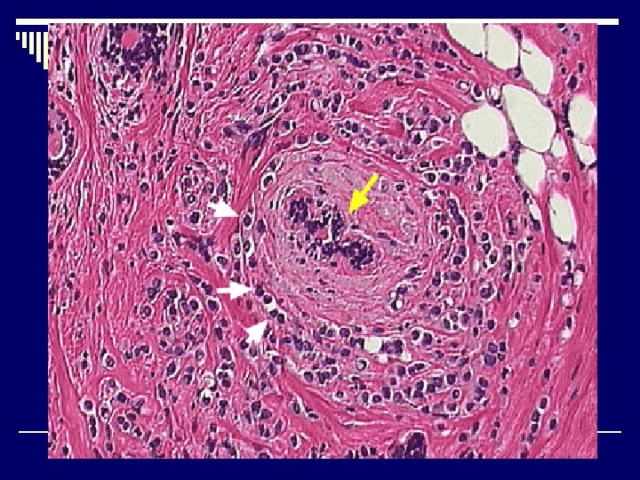 The Pathology of the BREAST Anatomy Physiology o