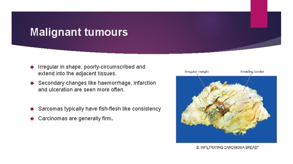 NEOPLASIA DIFFERENCE BETWEEN BENIGN MALIGNANT TUMORS ROUTES OF