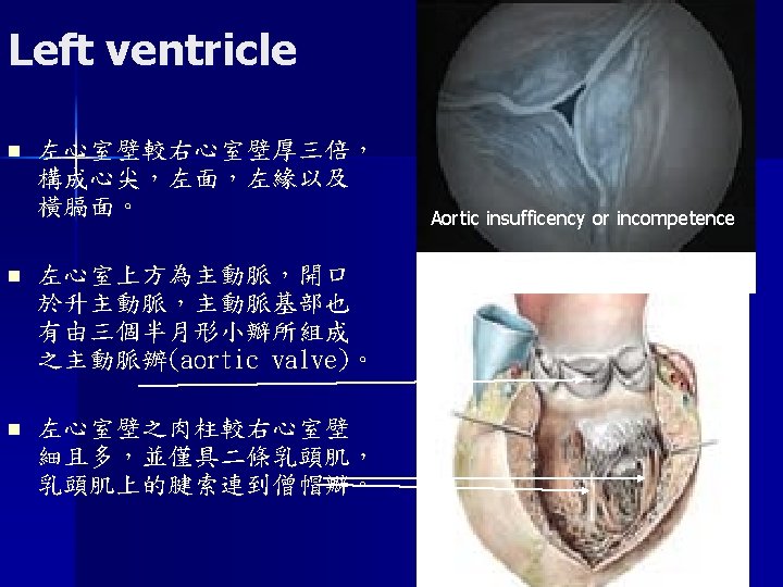 Morphology of the heart Cardiac size and shape