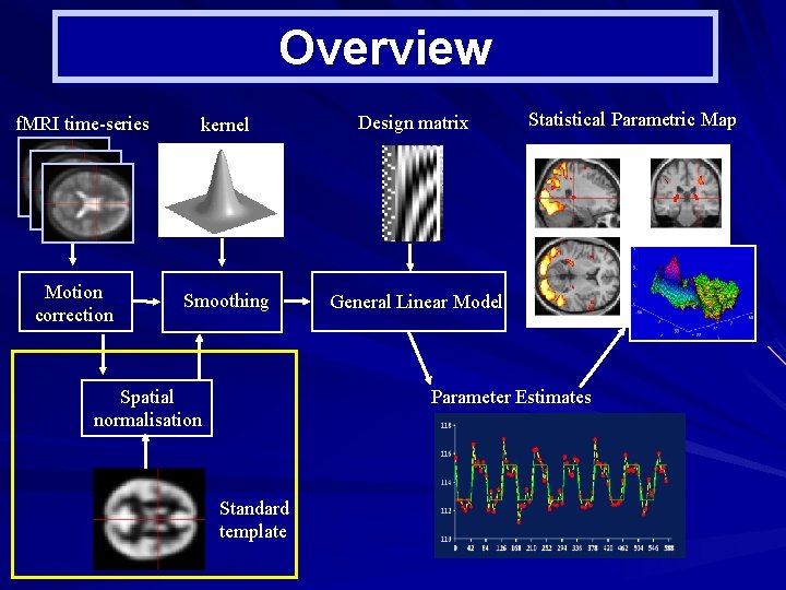 Overview f MRI timeseries Motion correction kernel Design