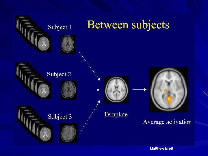 Overview f MRI timeseries Motion correction kernel Design