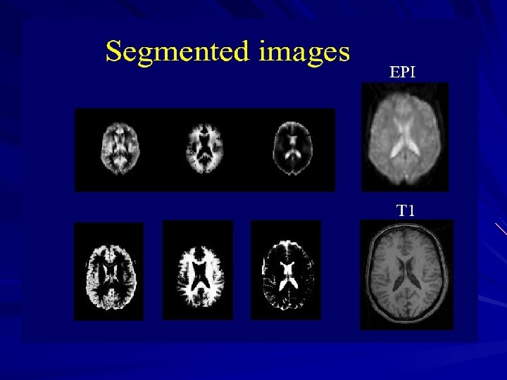 Overview f MRI timeseries Motion correction kernel Design